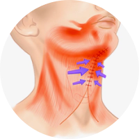 MINE Plastic Surgery | Korean Double Chin : remove double chin fat