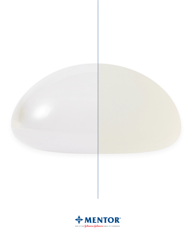 MINE Mentor Breast Surgery | MINE Plastic Surgery