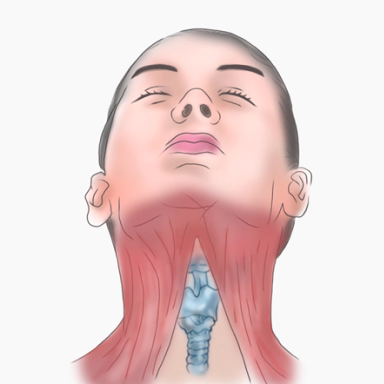 MINE Plastic Surgery | Korean Double Chin : remove double chin fat