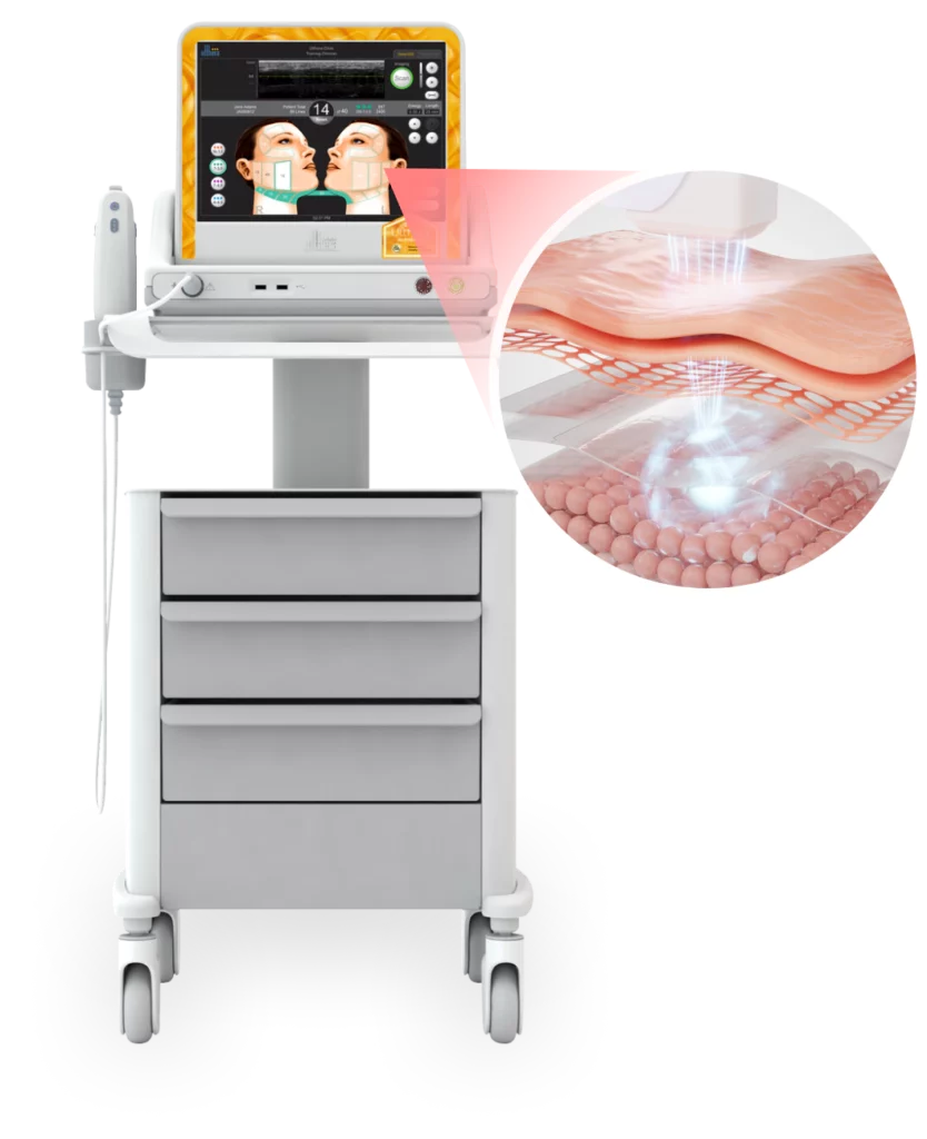 MINE Plastic Surgery | Ulthera Powerful lifting equipment