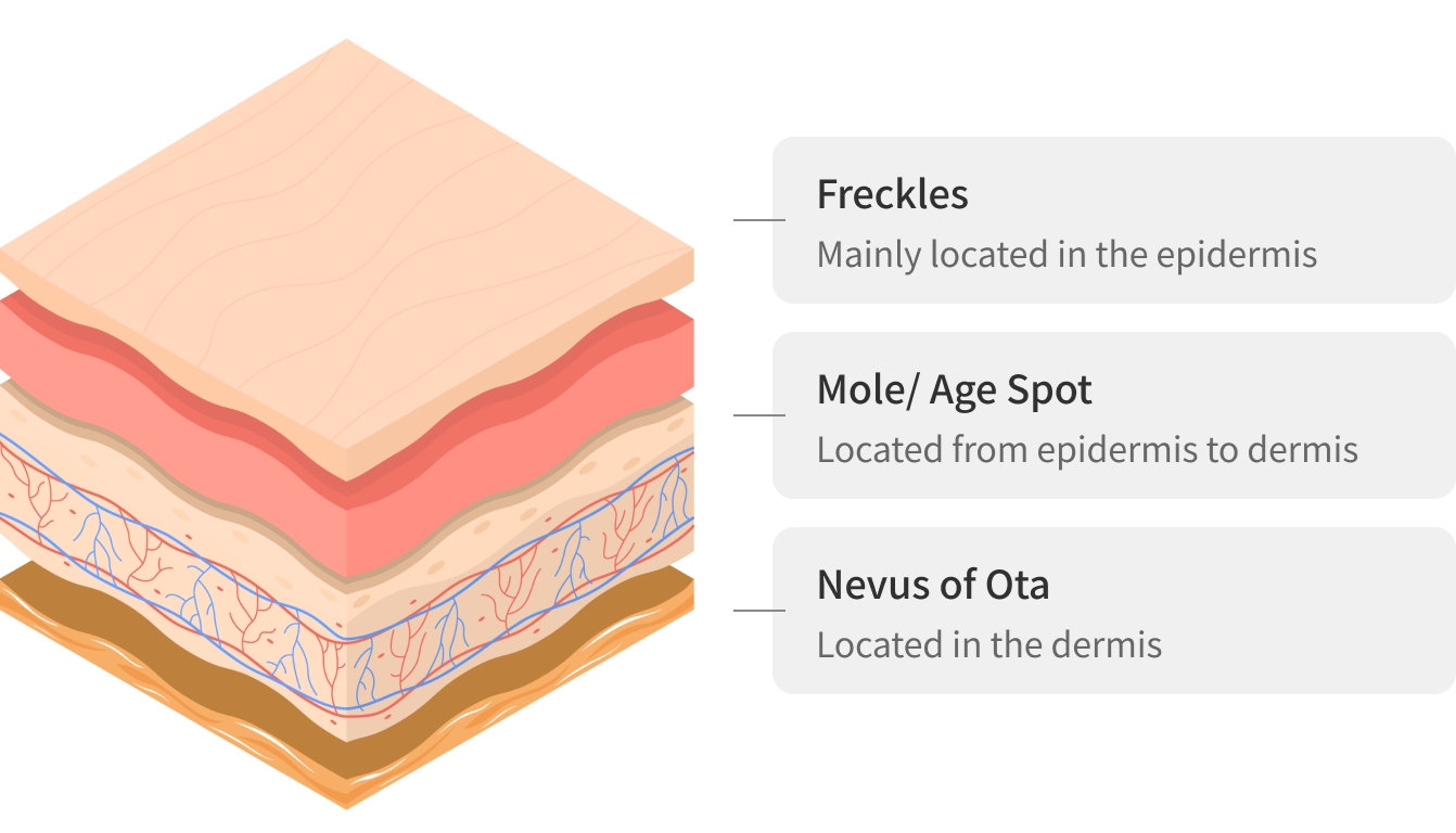Dermatology in Korea: Skin Brightening| MINE Plastic Surgery