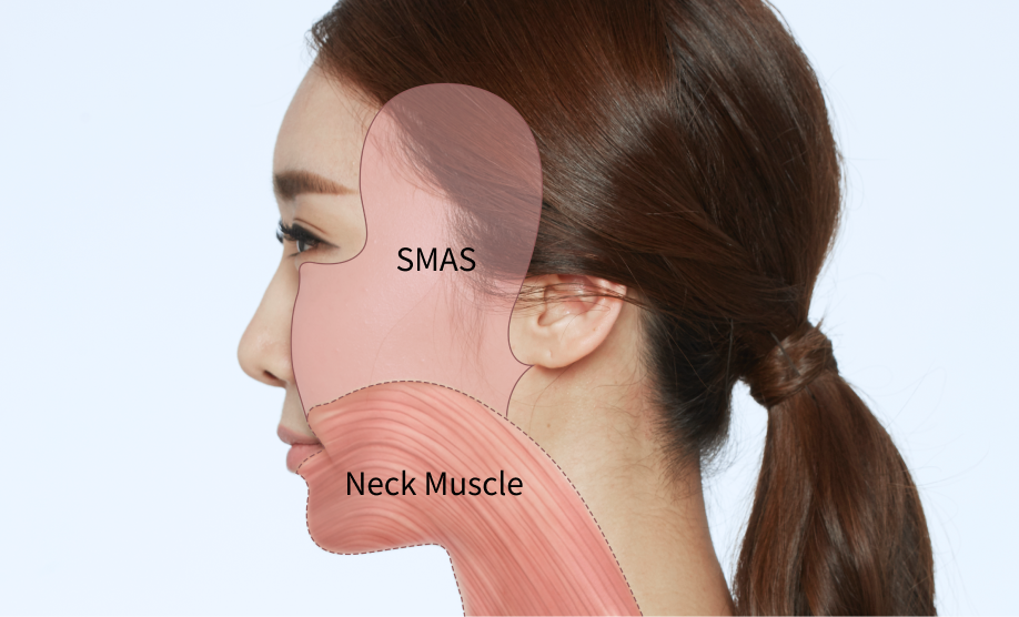 Korean Neck Lift for neck antiaging | MINE Plastic Surgery