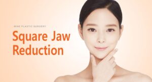 Square Jaw Reduction Surgery Korea | MINE Plastic Surgery