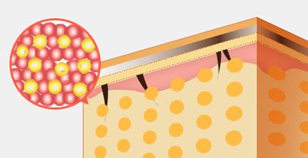 Facial Line Fat Grafting Surgery Korea | Face Fat Grafting