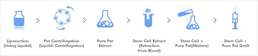 Stem Cell Therapy Korea - raise survival rate and rejuvenate