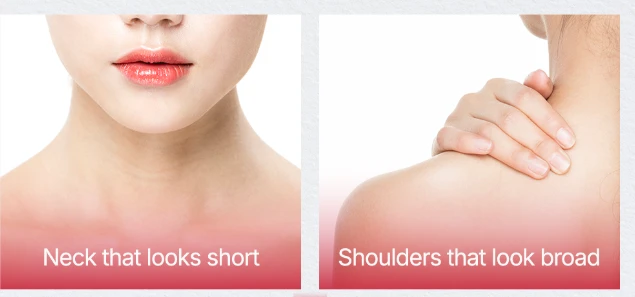How to Relax Raised Shoulders with Trapezius Botox in Korea | MINE ...