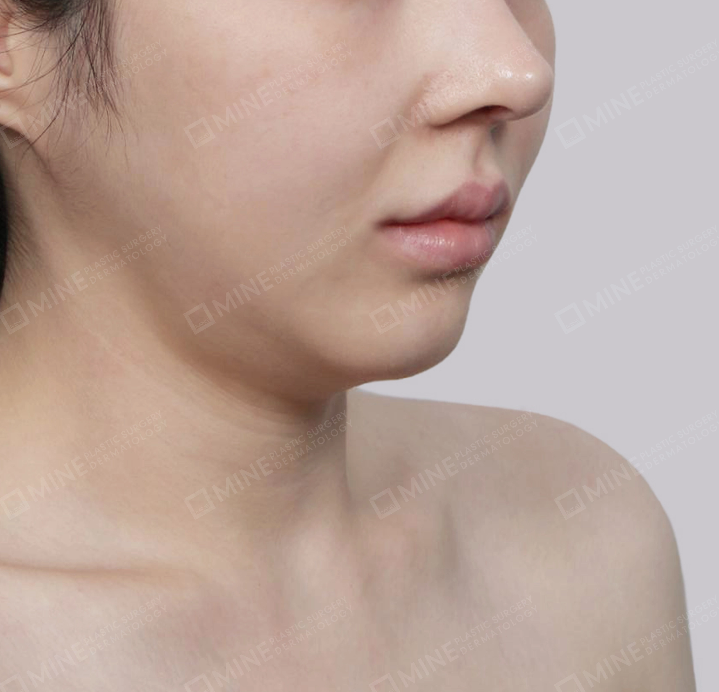 MINE Plastic Surgery | Before & After surgery results